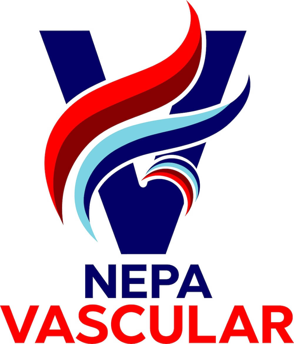 Peripheral Venous Disease (PVD) | NEPA Vascular